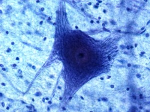 Mighty Microglia – The Brain's Immune Cells Key to Treating Brain ...